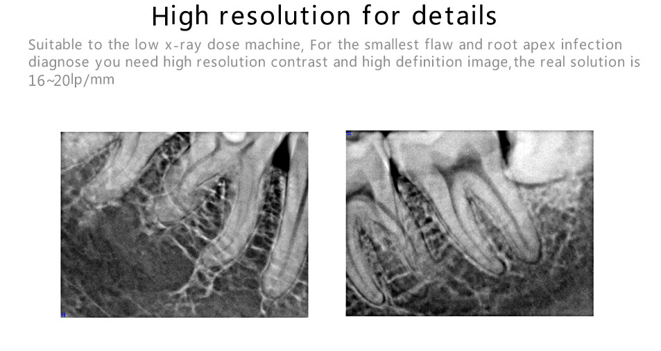 HDR600 RVG portable dental digital x-ray Imaging sensor with USB wire